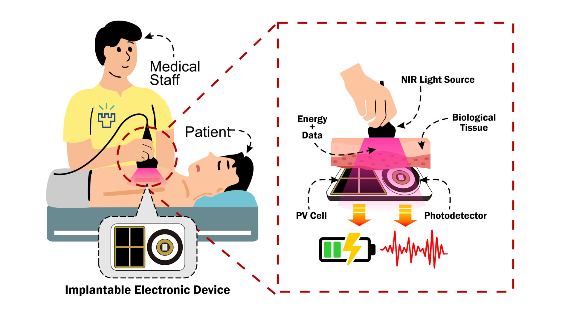 Powering and communicating with implantable medical devices using NIR ...